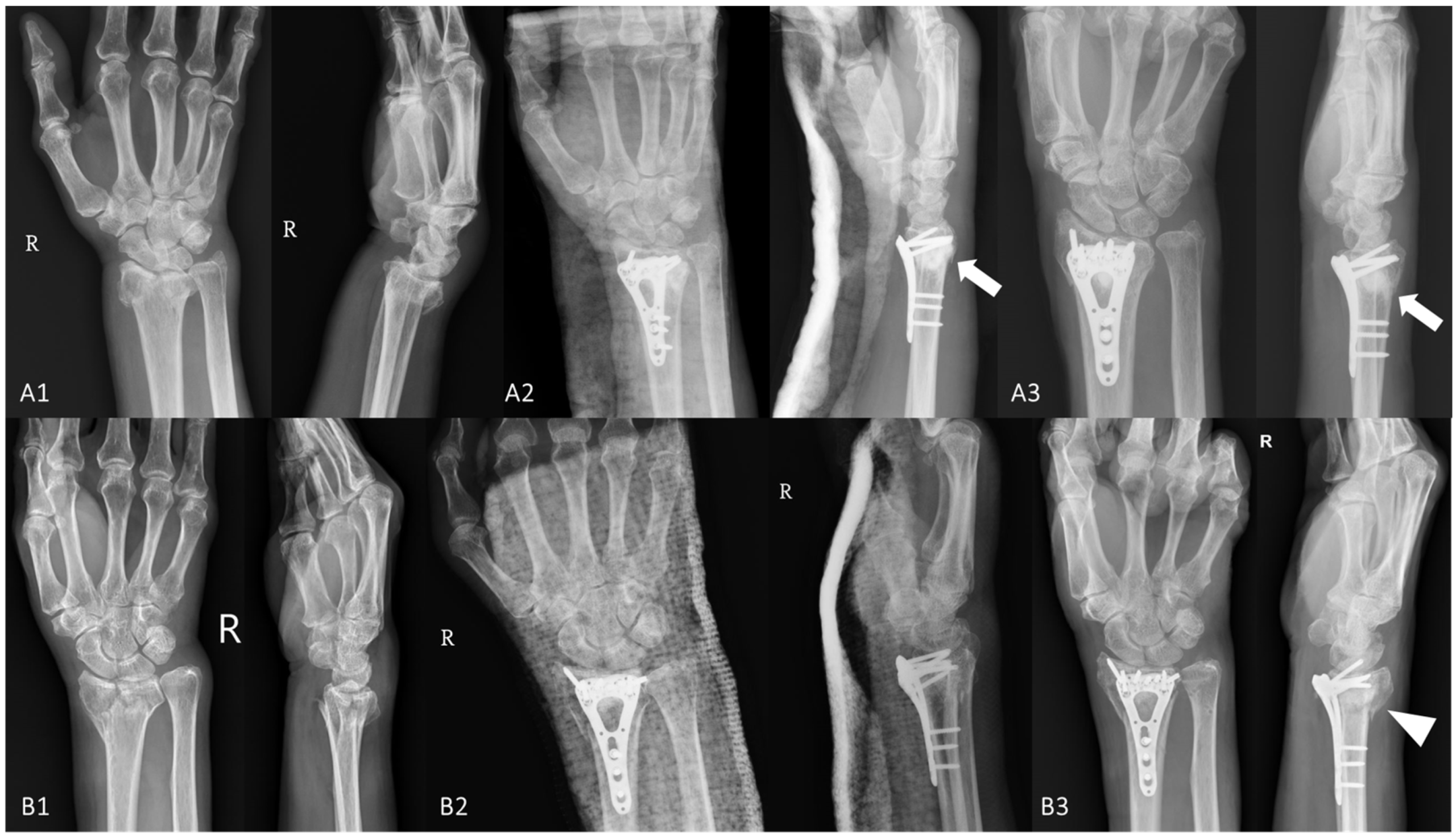 The ArmDoc - Distal Radius Fractures