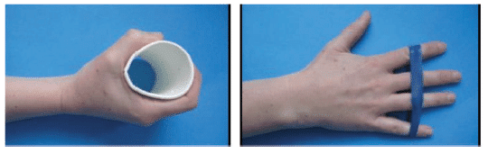 The ArmDoc - Extensor Hood injuries