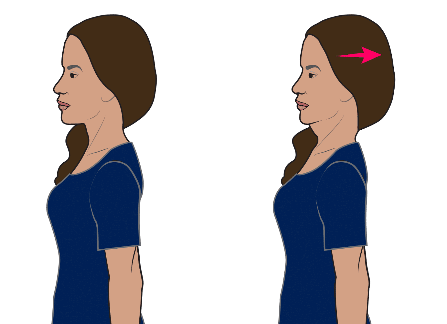 The ArmDoc - Thoracic Outlet Syndrome