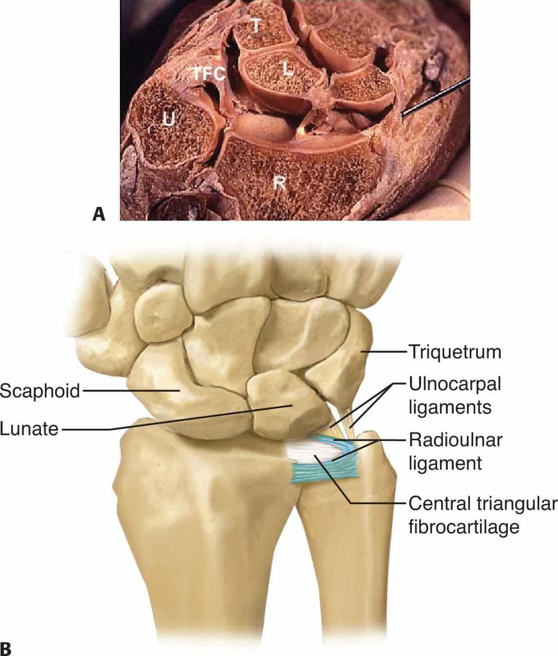 The ArmDoc - Arthroscopic and Open Triangular Fibrocartilage Complex Repair