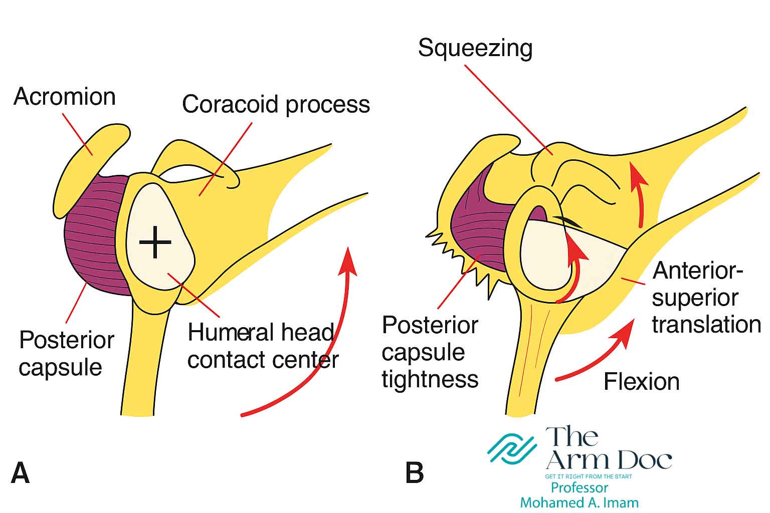 The ArmDoc - Glenohumeral Internal Rotation Deficit (GIRD)