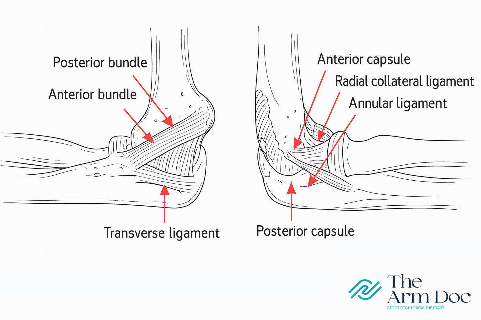 The ArmDoc - Posterolateral instability of the elbow