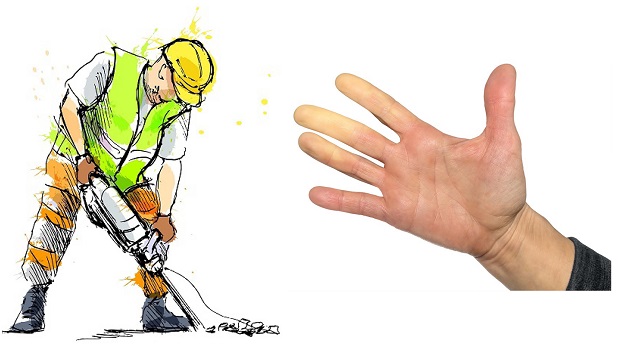 The ArmDoc - Hand‑Arm Vibration Syndrome